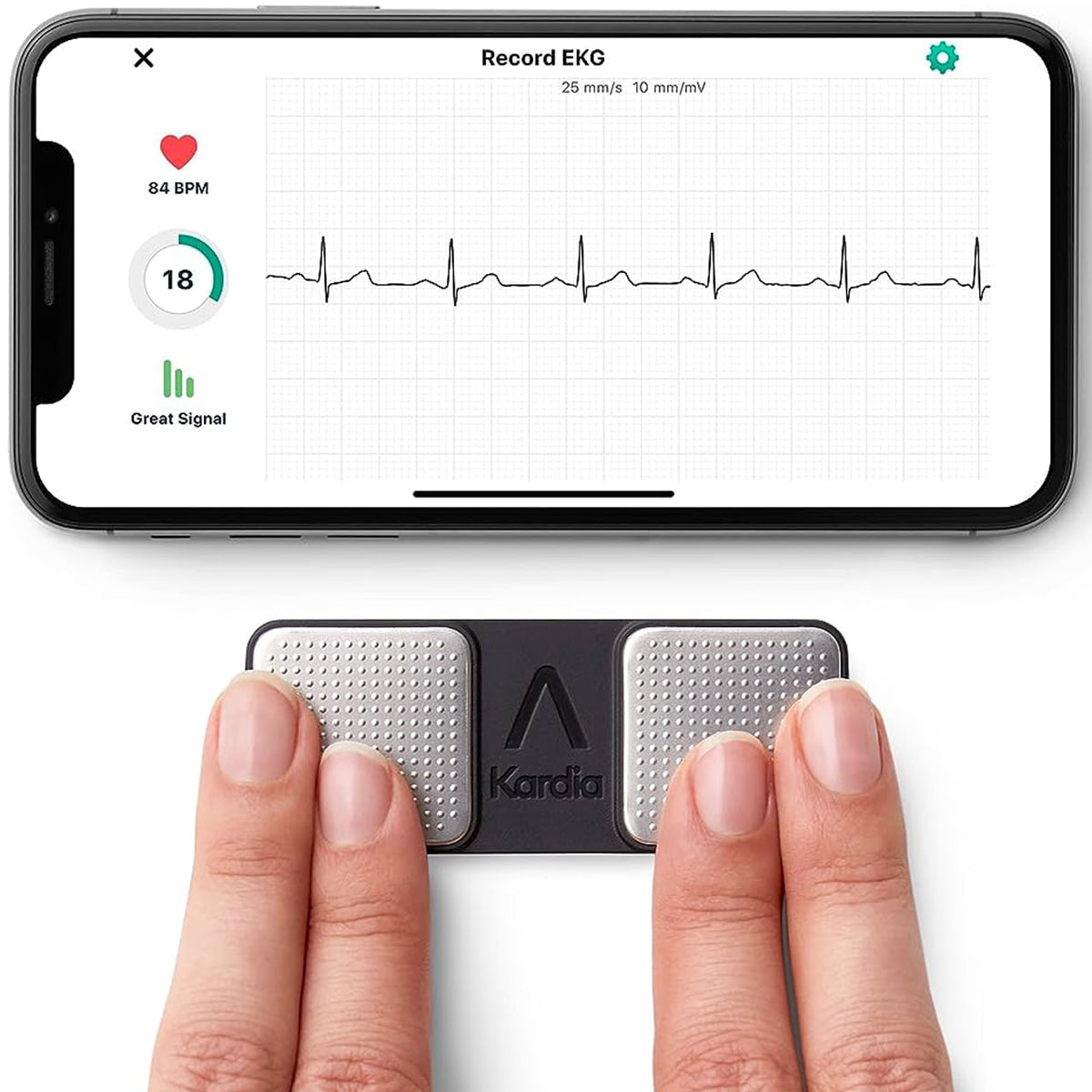 My Review of AliveCor Kardia Mobile EKG for Heart Palpitations ...